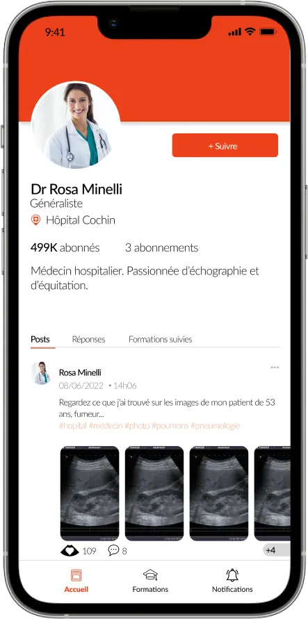 echOpen | Prix des Sondes et Abonnements