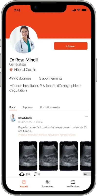 echOpen | Prix des Sondes et Abonnements
