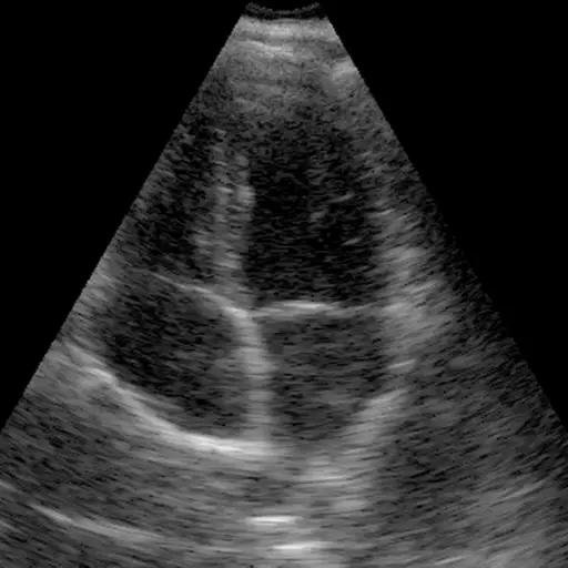 echOpen | l'échographie clinique simple et accessible | Made in France