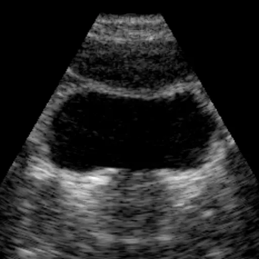 echOpen | l'échographie clinique simple et accessible | Made in France