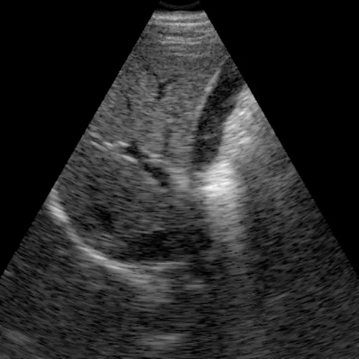 echOpen | l'échographie clinique simple et accessible | Made in France