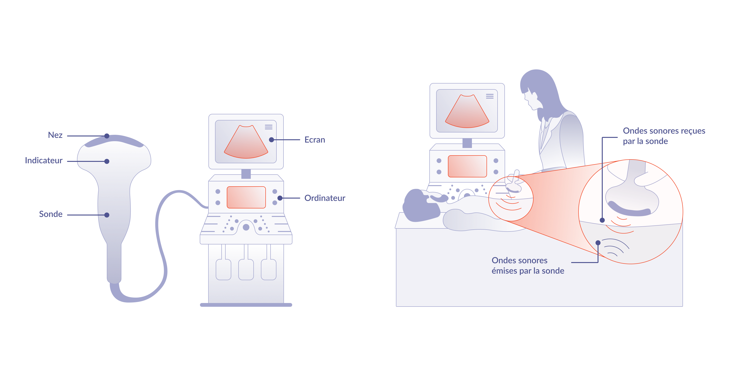Formation à l'échographie : comment bien manipuler la sonde