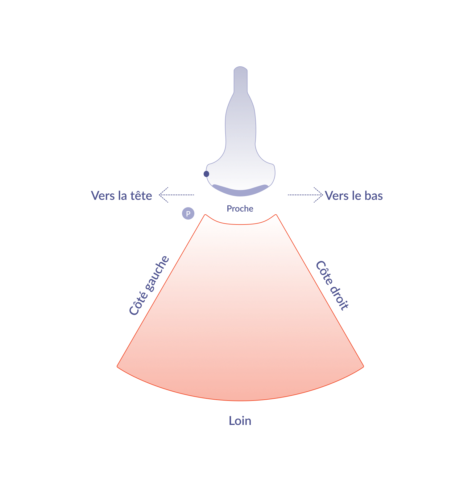 Formation à l'échographie : comment bien manipuler la sonde