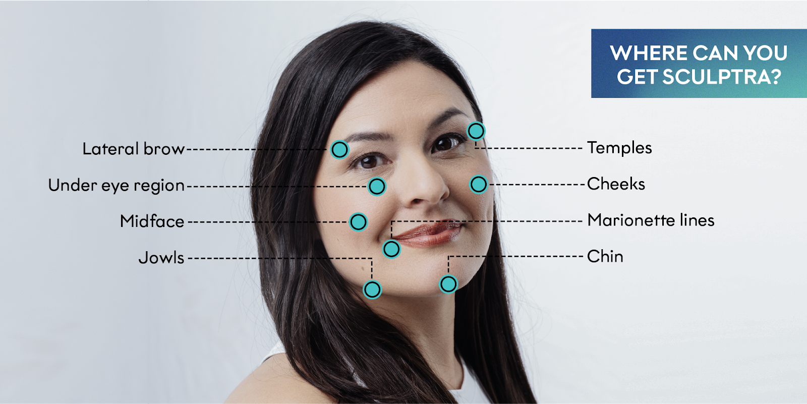 What Is our Sculptra® treatment? All you need to know.