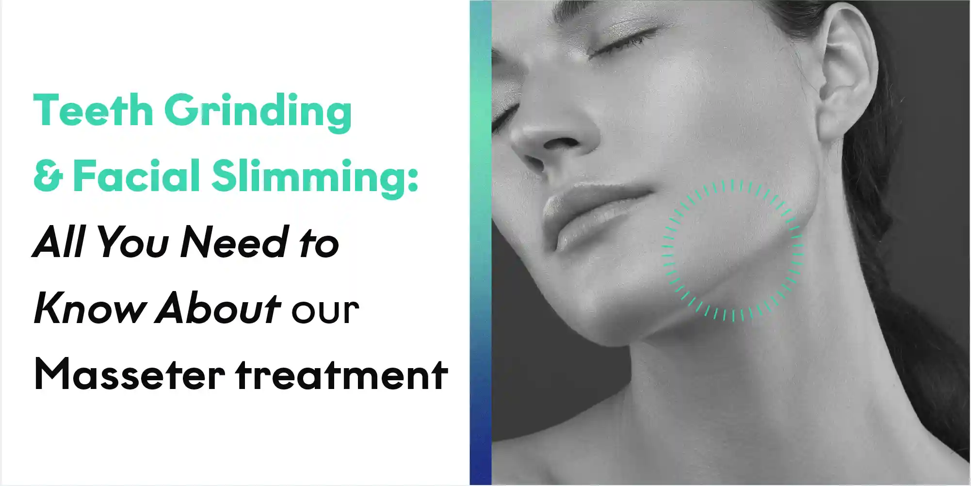 All You Need to Know About Our Masseter Treatment