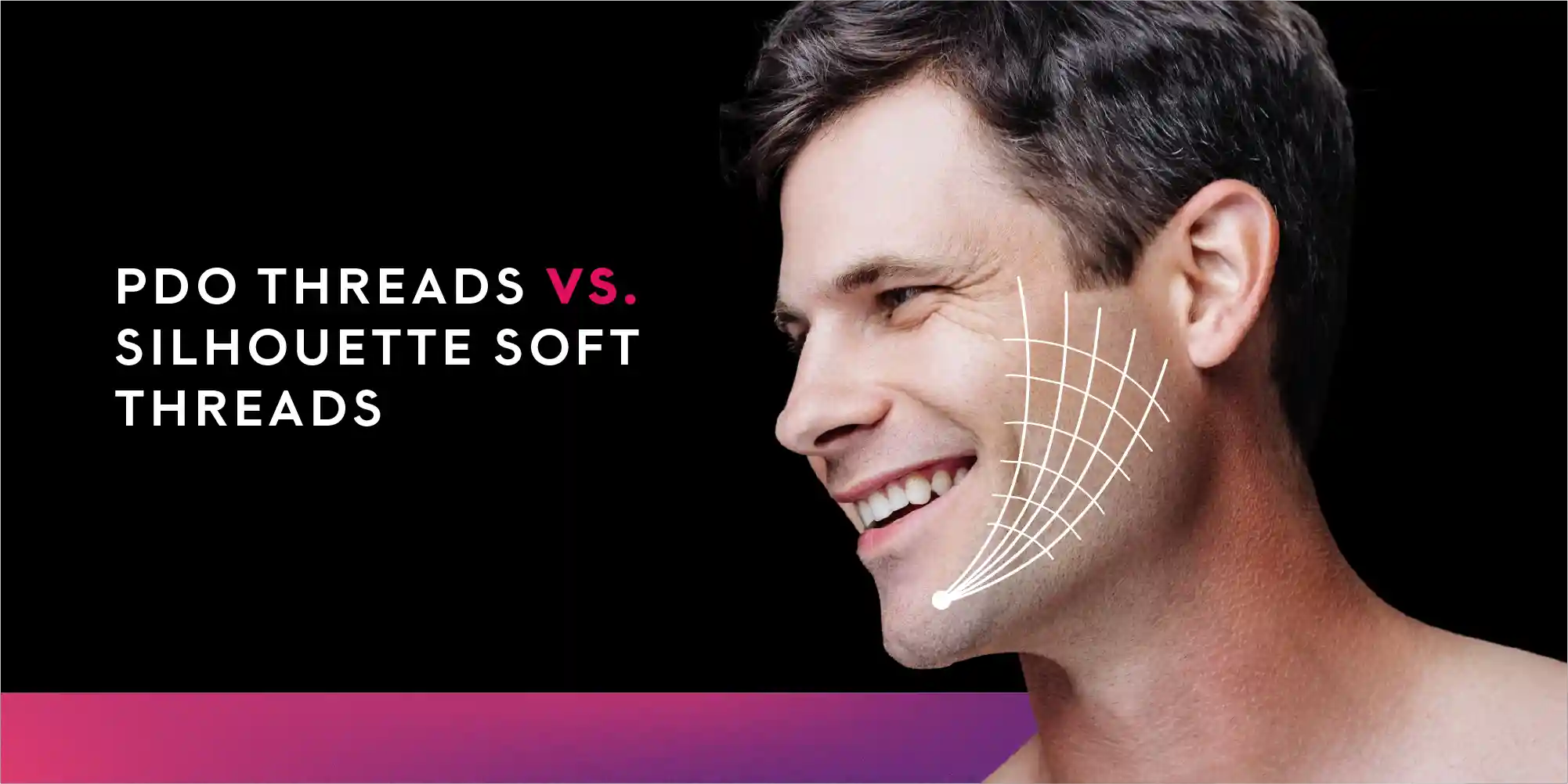 What are Thread Lift treatments? Everything you need to know.