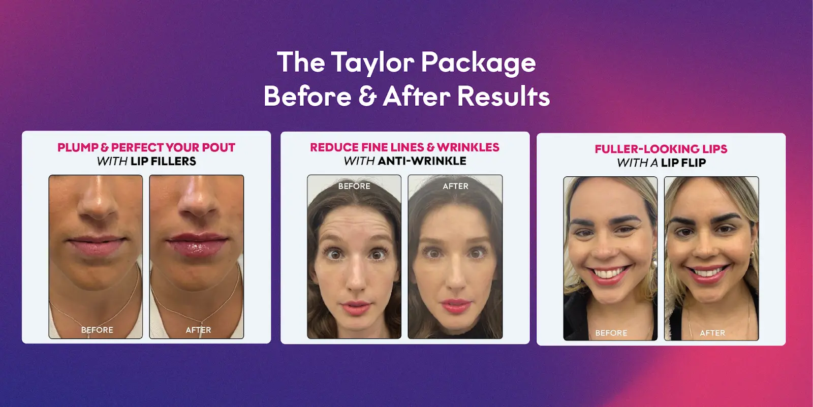 Try our Taylor Special and experience the ultimate combo of Botox, Lip ...