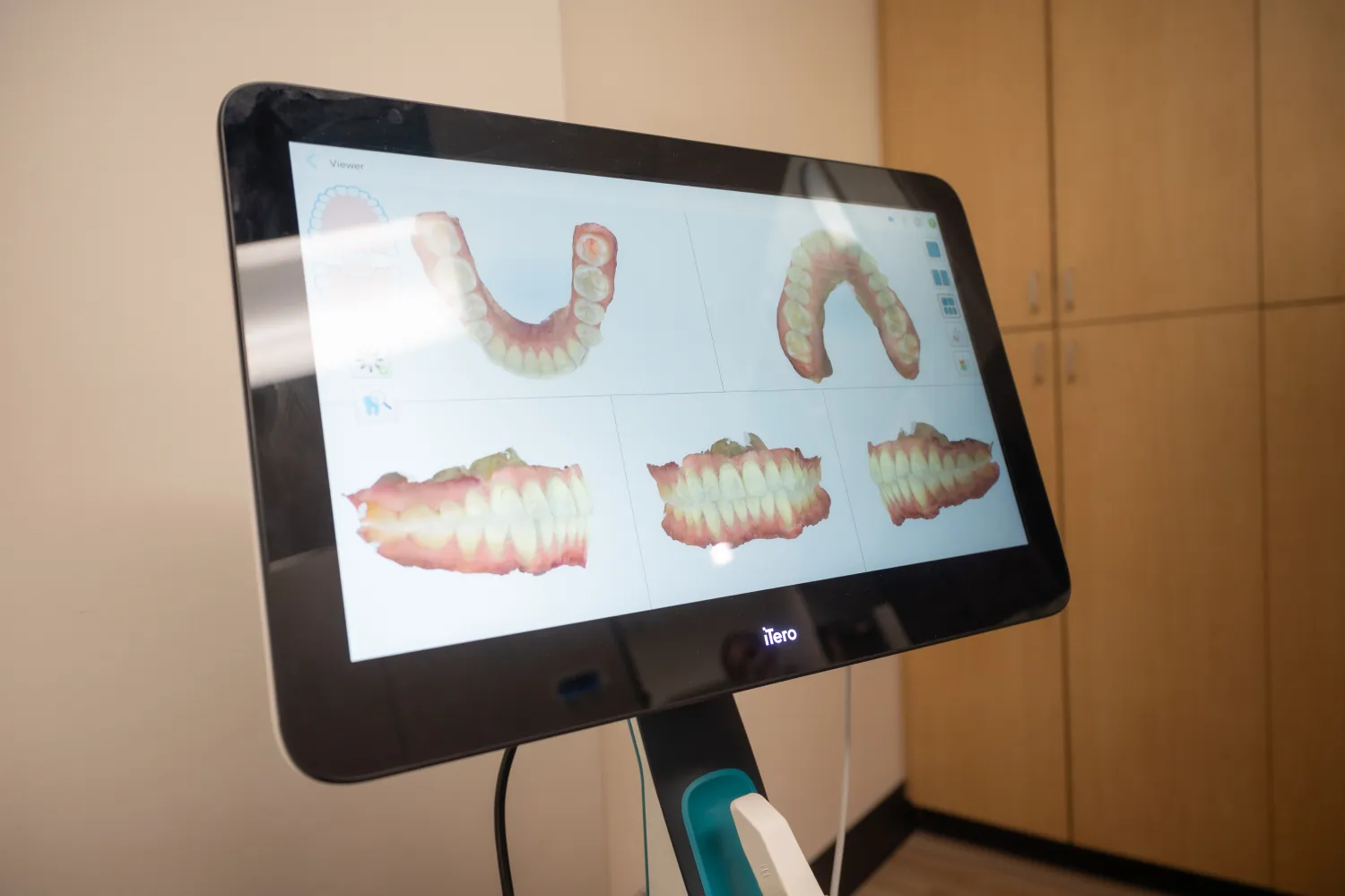 Invisalign in Santee, CA | Confident Smiles