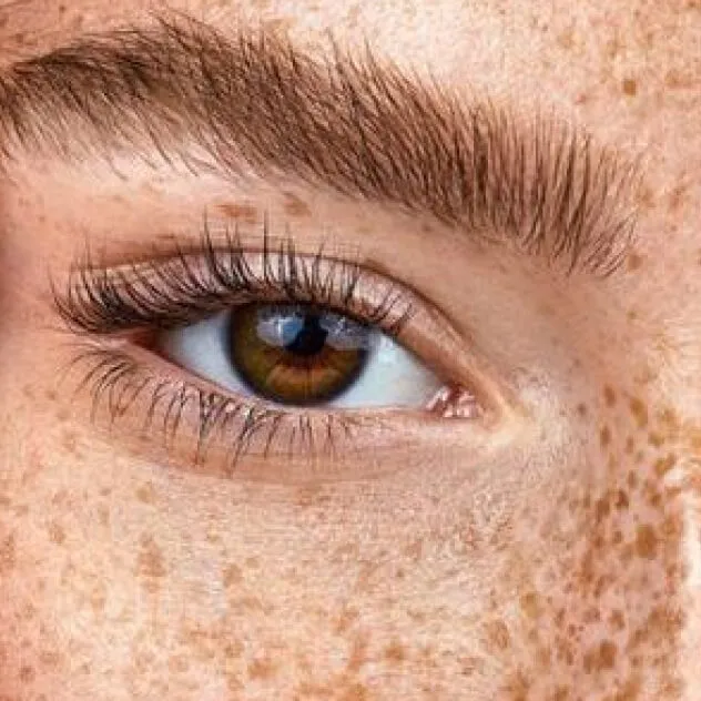 Full Body Mole Check Services