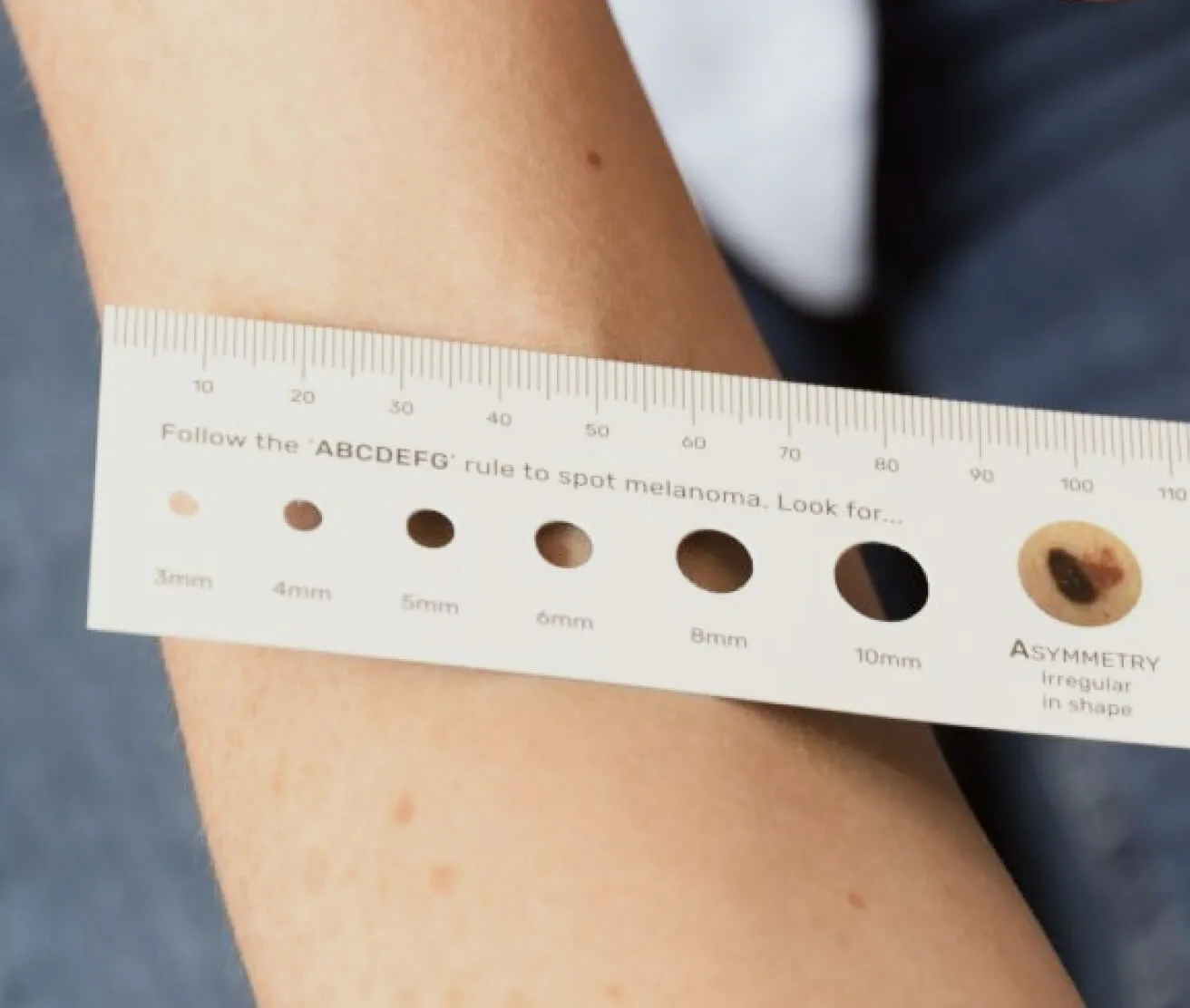 Mole Map, Skin Check Diagnosis and Treatment Services