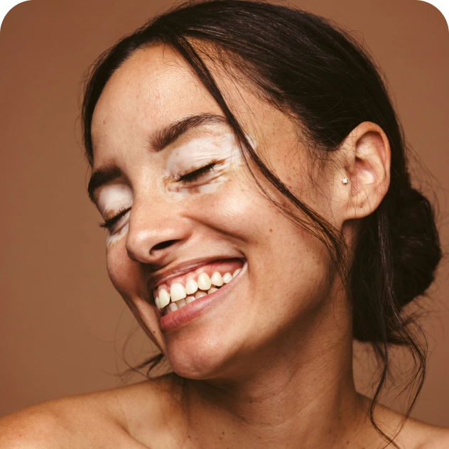 Full Body Mole Check Services