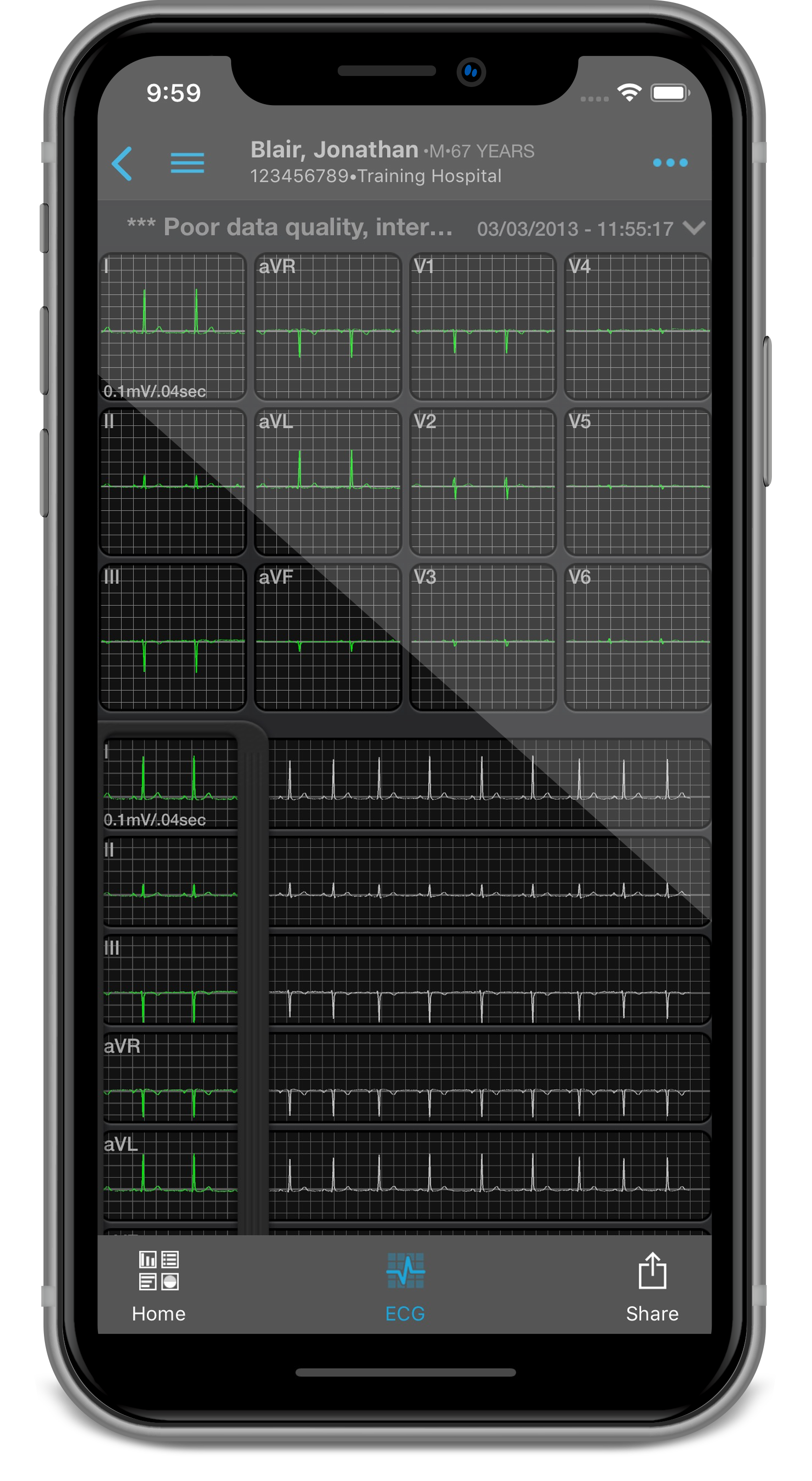 AirStrip® | Products | Cardiology