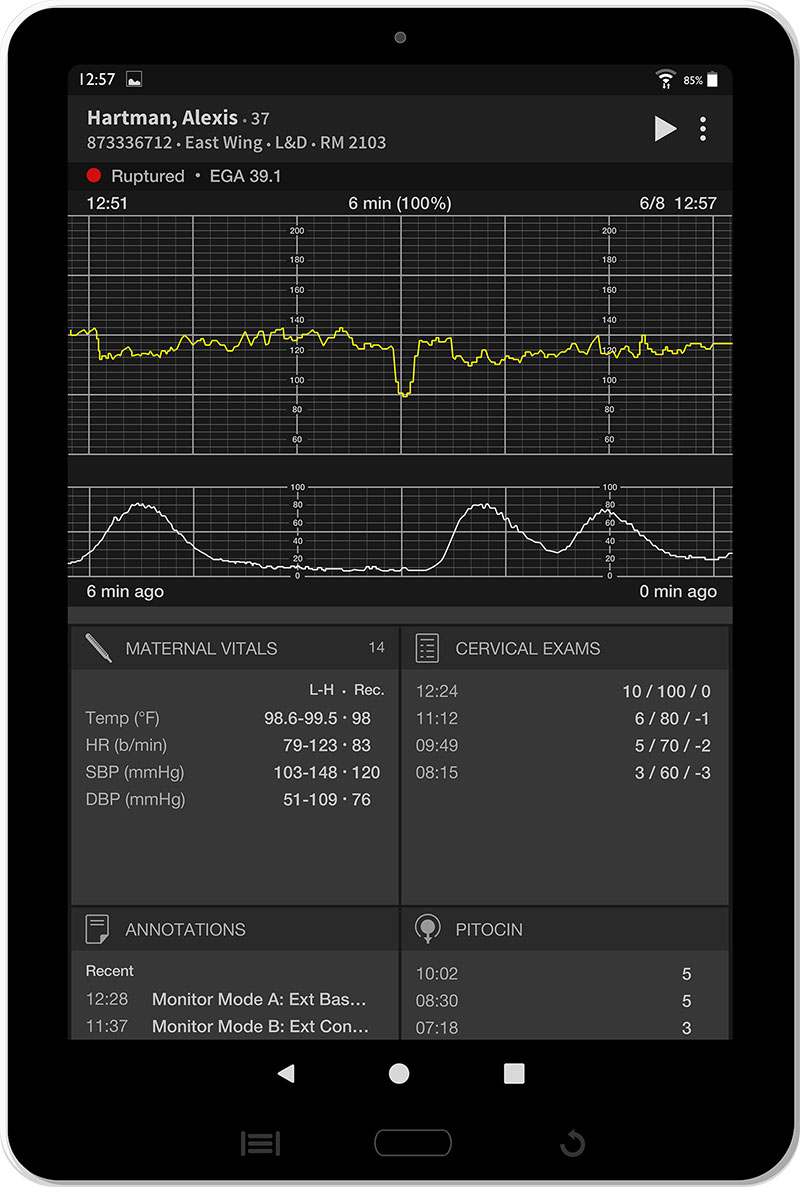 AirStrip® | Workflows | Maternal & Fetal Waveforms