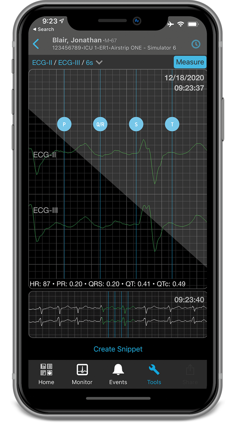 AirStrip® | Products | Patient Monitoring