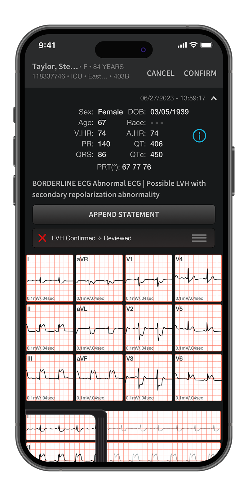 AirStrip® | Products | Cardiology