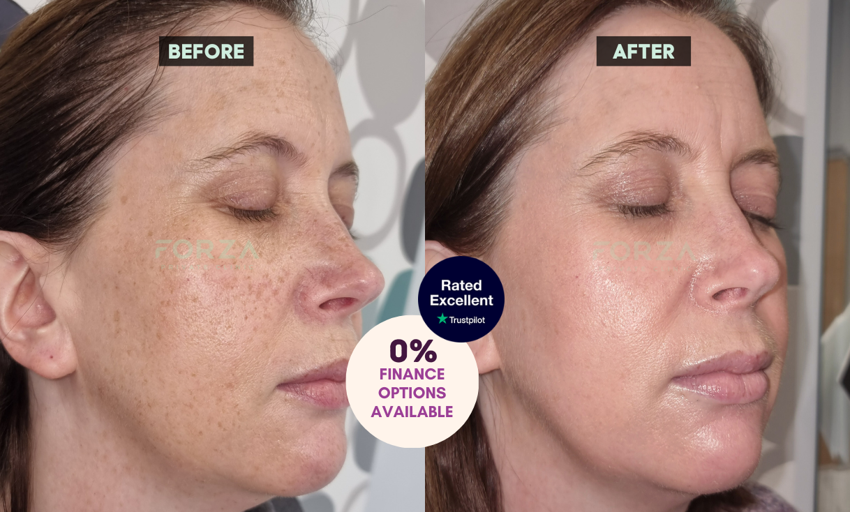 65429103db1451e2f2d23648_Cosmelan (1).png