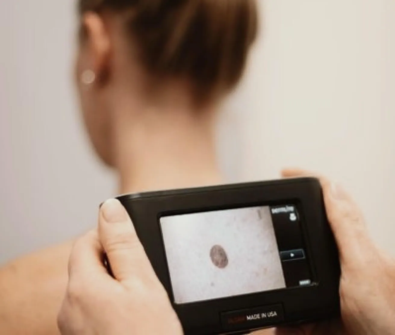 Brisbane Skin Cancer Clinic: Check, Detect, Treat