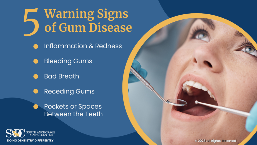 The Early Signs of Gum Disease: 5 Things to Look Out For | South ...