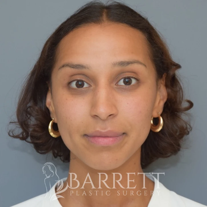 Weight Management Beverly Hills | Barrett Plastic Surgery