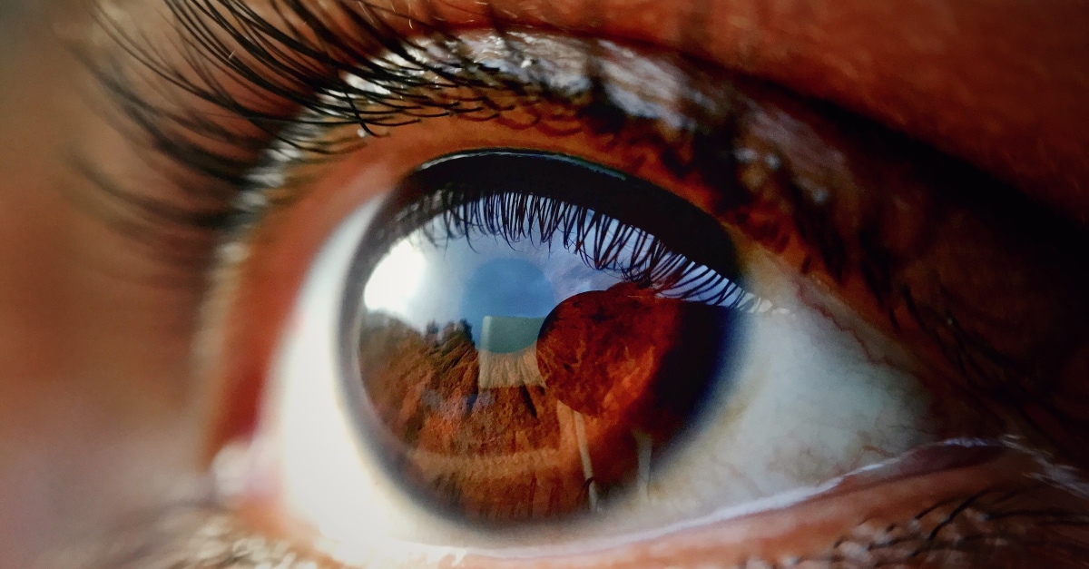 Keratoconus - Rose Optometry