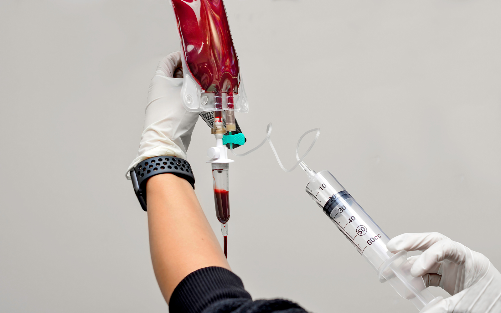 IV Ozone Therapy (Major Autohemotherapy - MaH) Uses, Benefits, Side ...