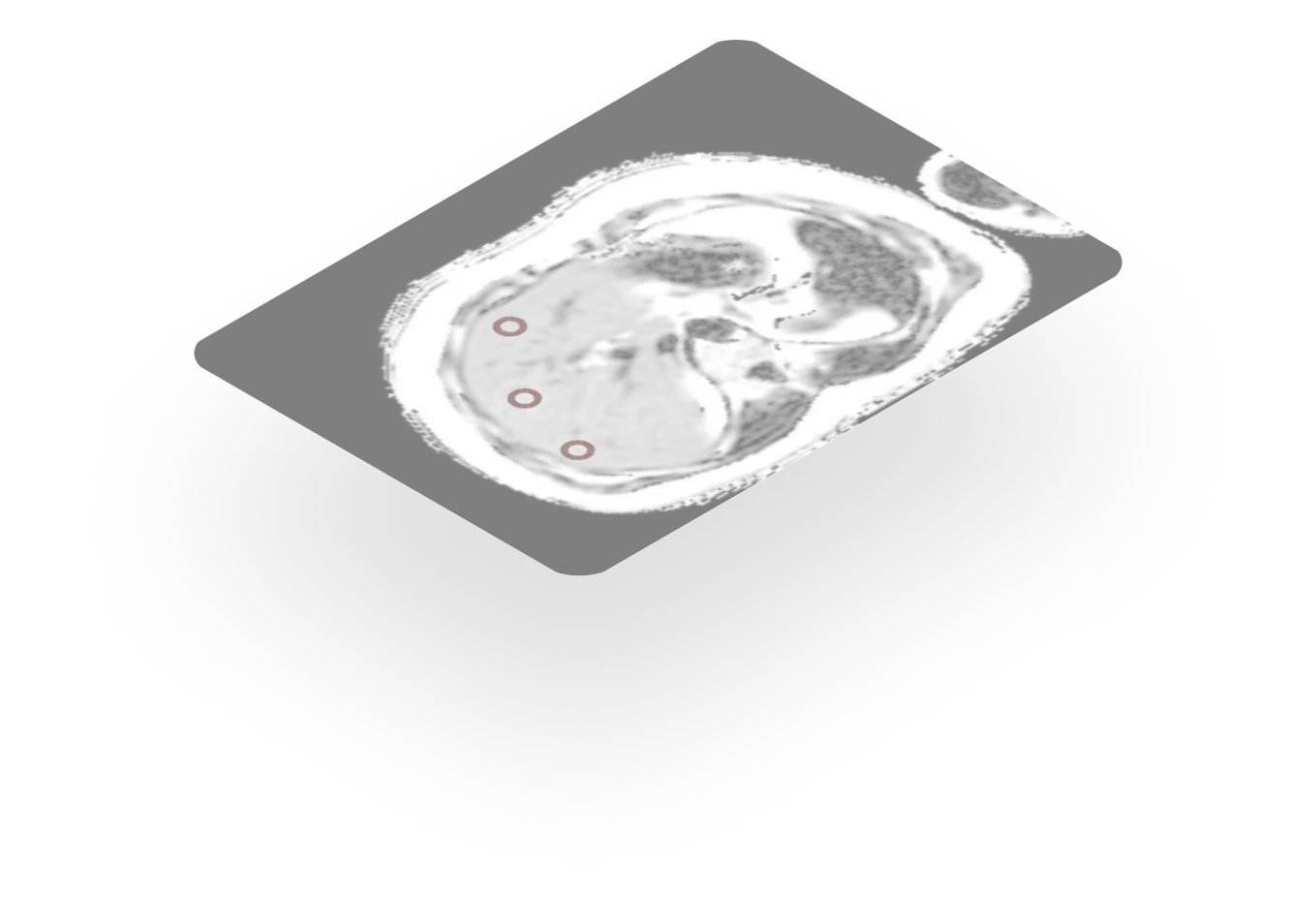 Perspectum | Perspectum