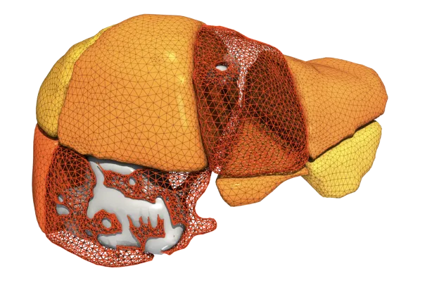 Our Products | Perspectum