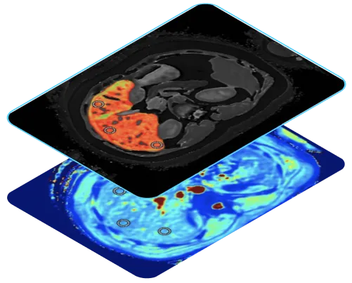 Our Products | Perspectum