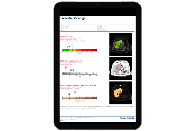 LiverMultiScan | Perspectum