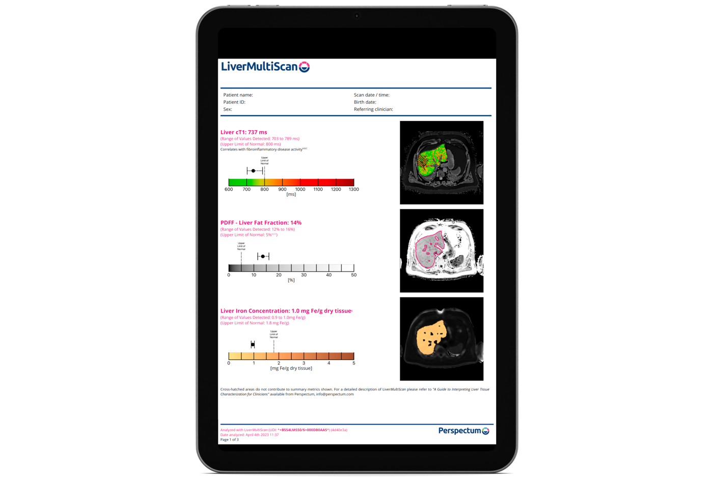 LiverMultiScan | Perspectum