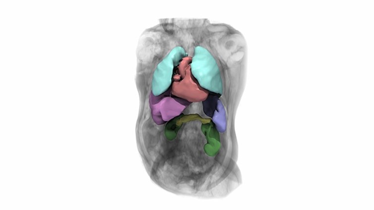 FDA Grants Clearance to Perspectum’s CoverScan – A New Platform-Based ...