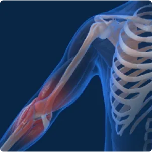 Home : OrthoPedia Patient