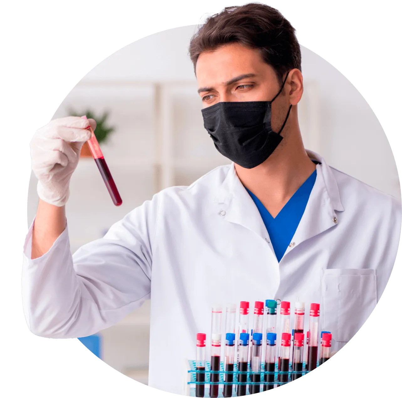 PROphetNSCLC Test | OncoHost's Lung Cancer Test