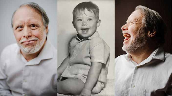 What are the Five Developmental Disabilities?