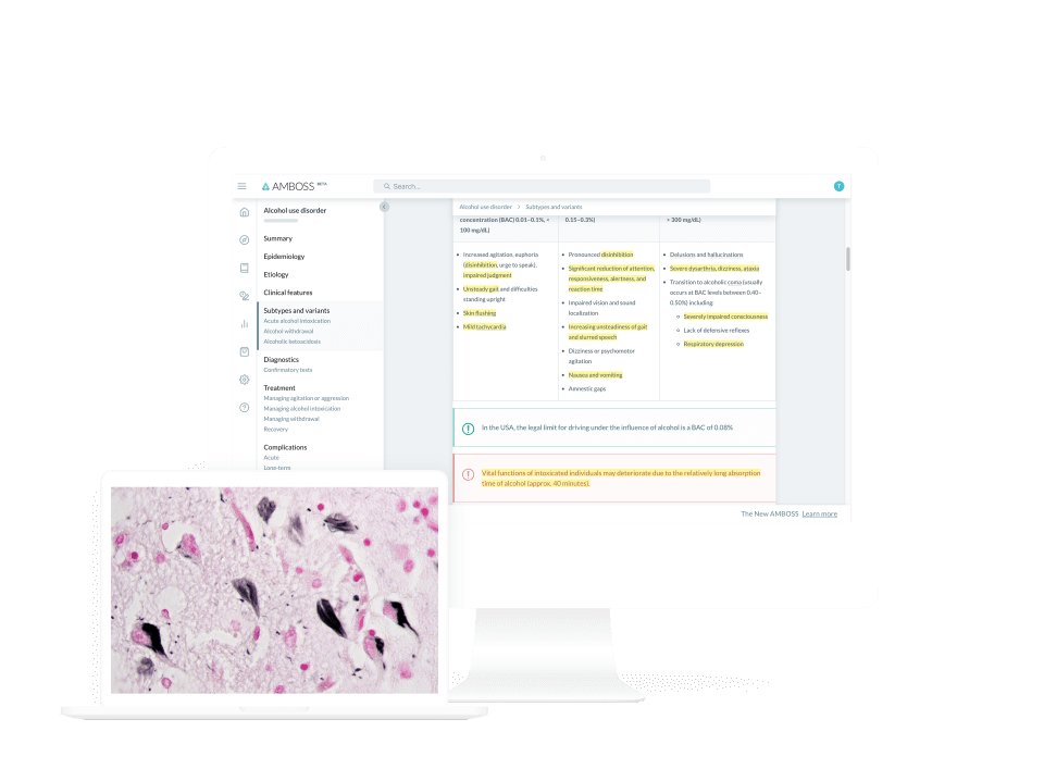 Score high on the NBME® Psychiatry Shelf exam with AMBOSS