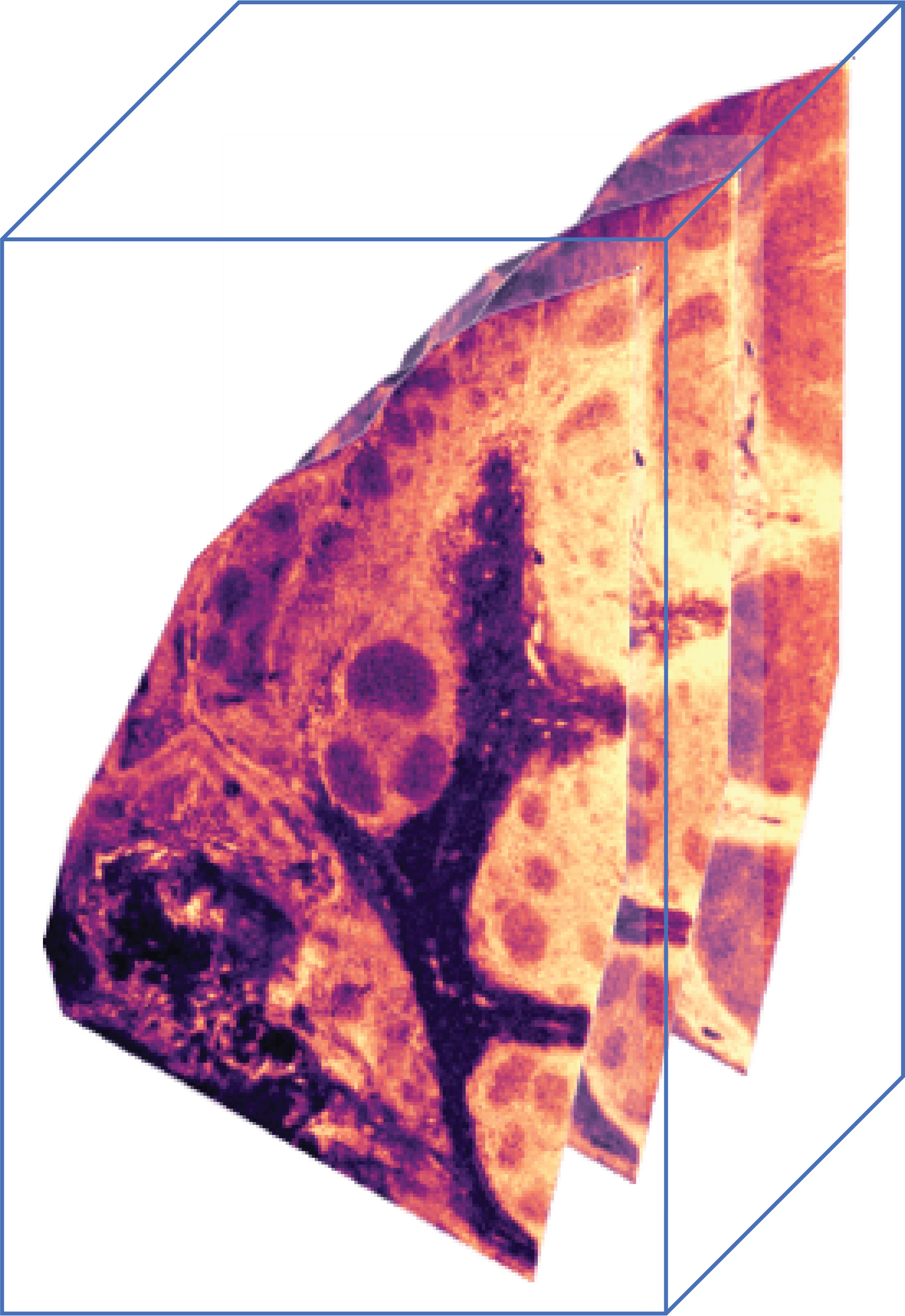 Introduction To Mass Spectrometry Imaging Data Analysis Aspect