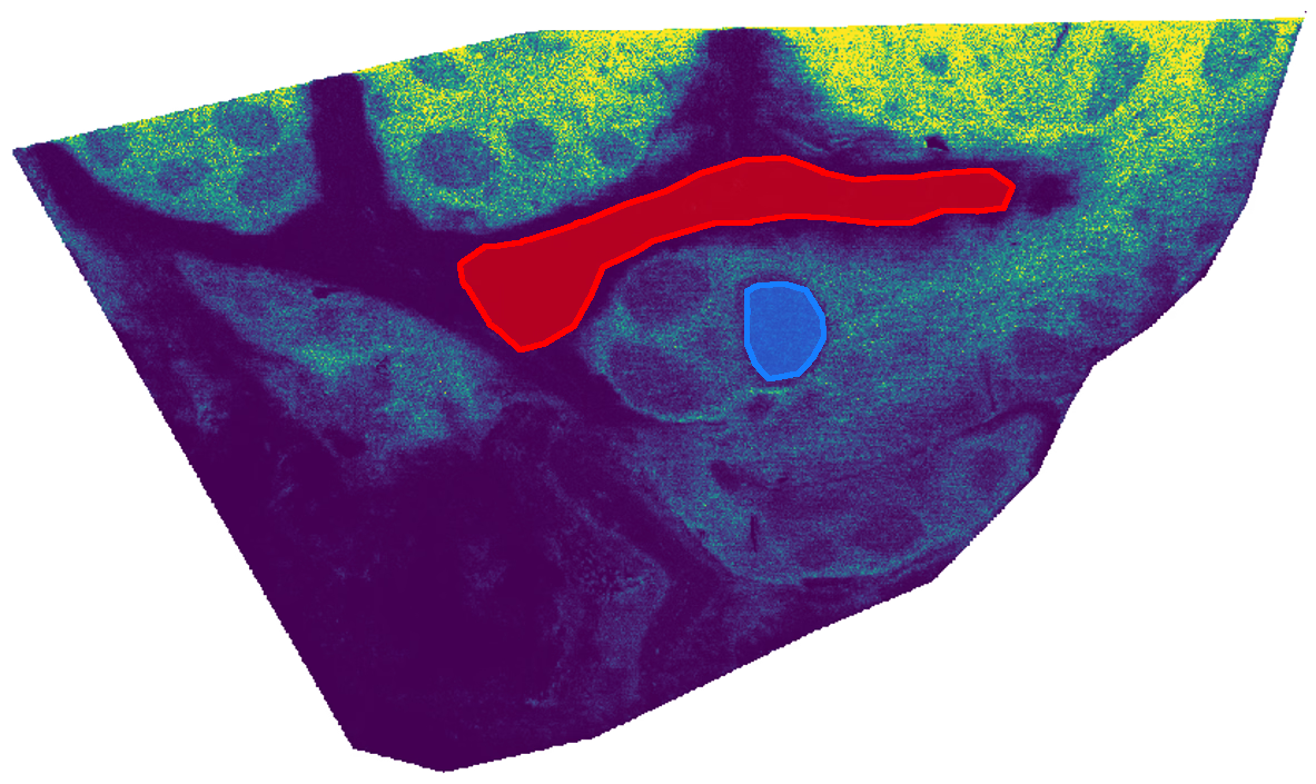 Introduction To Mass Spectrometry Imaging Data Analysis Aspect