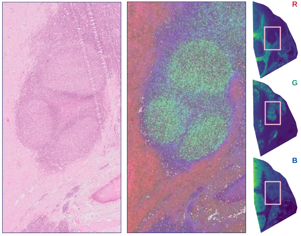 Spatially Aware Clustering Of Ion Images In Mass Spectrometry Imaging