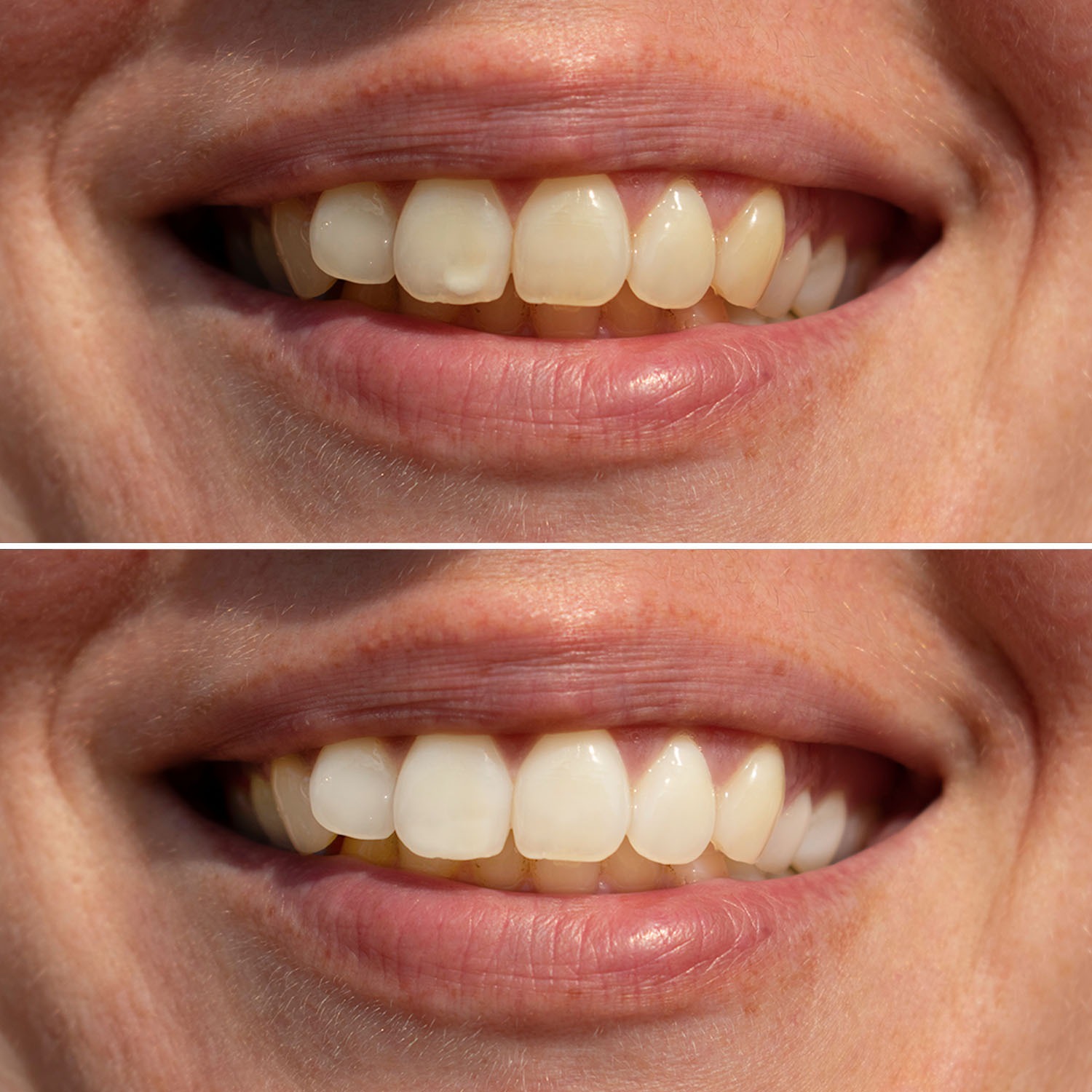 Cosmetic Dentistry | Dulku & Kang Dental, Nuneaton