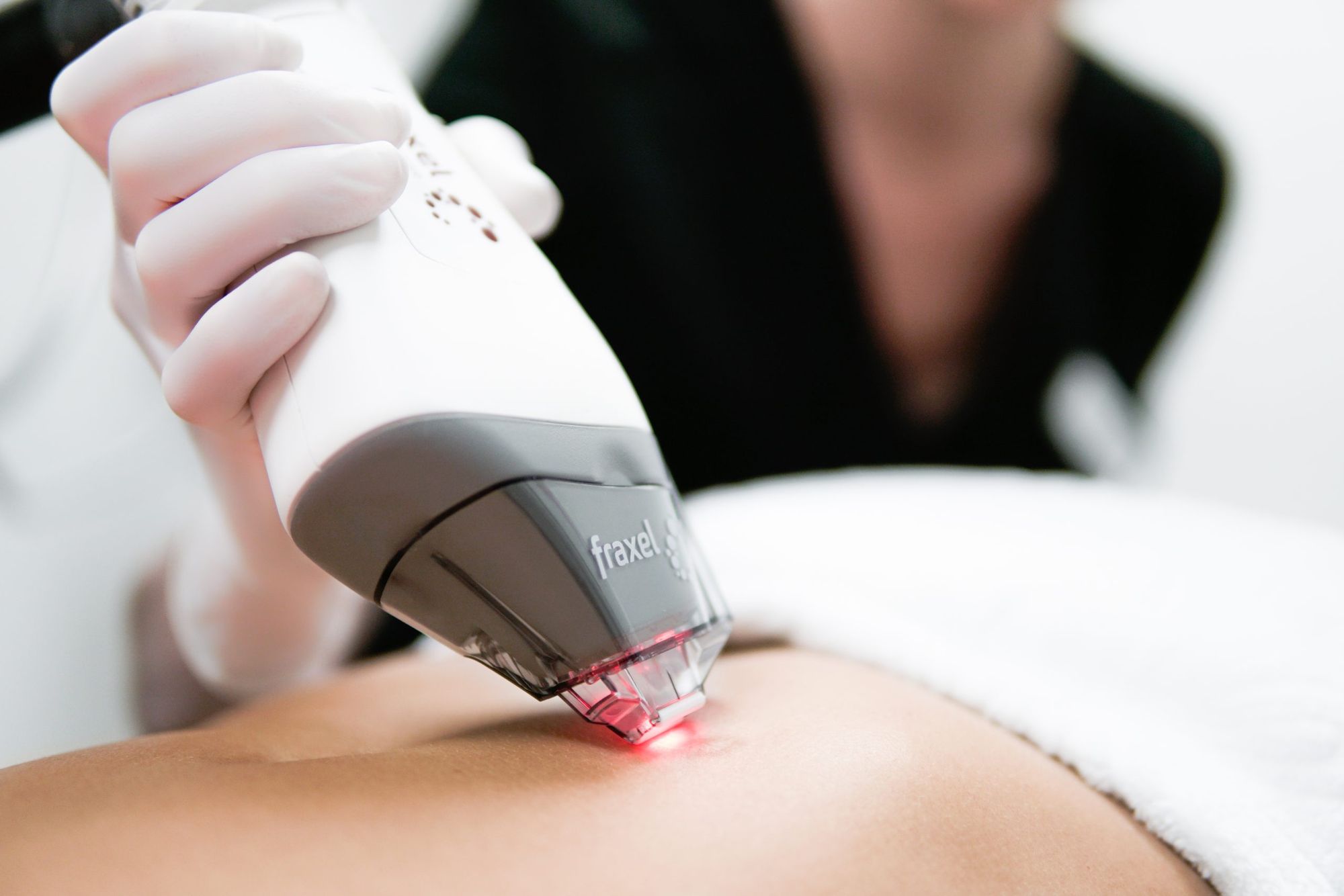 Fraxel® Dual Laser Treatment | Manhattan Dermatology