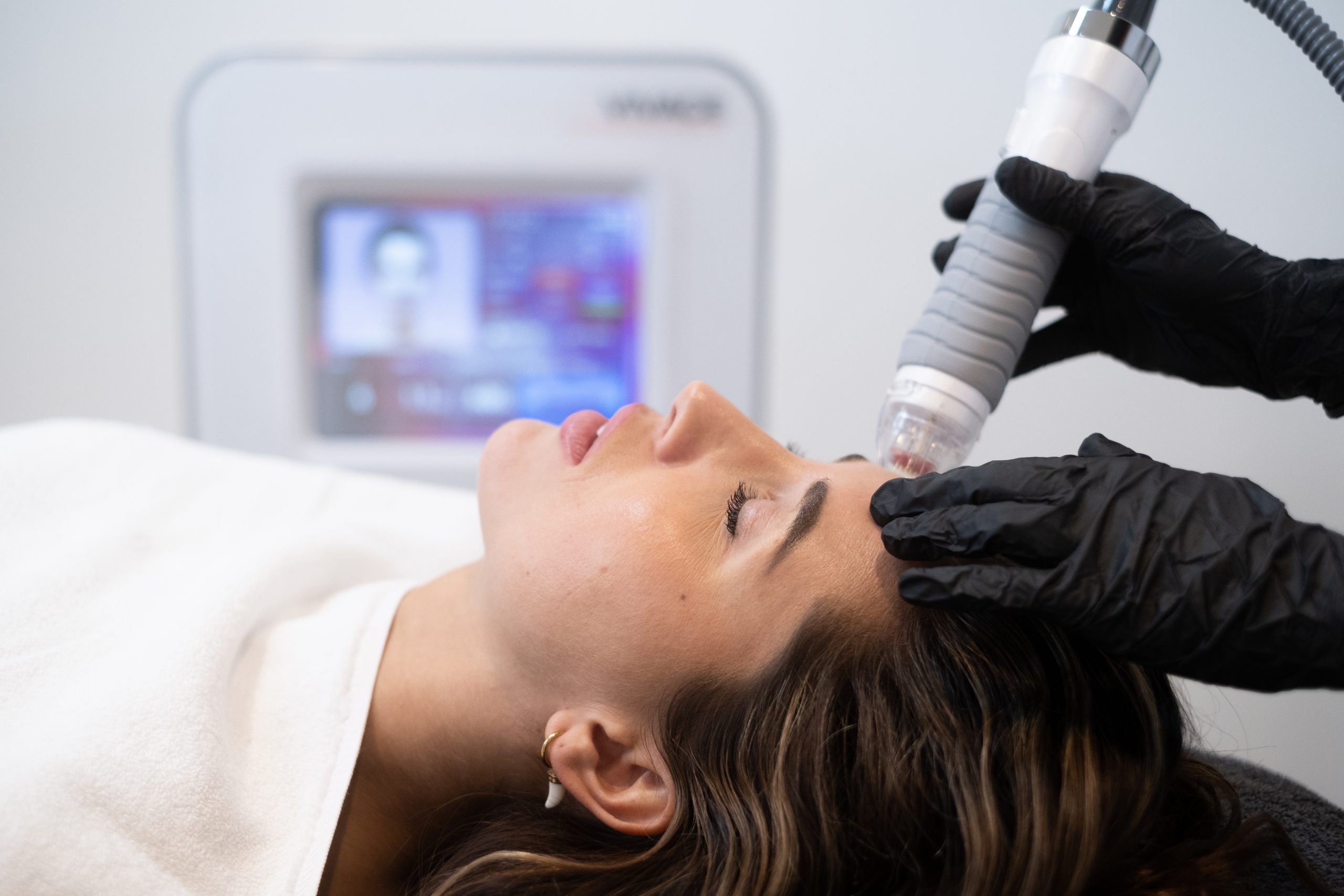 Vivace Microneedling RF | Manhattan Dermatology