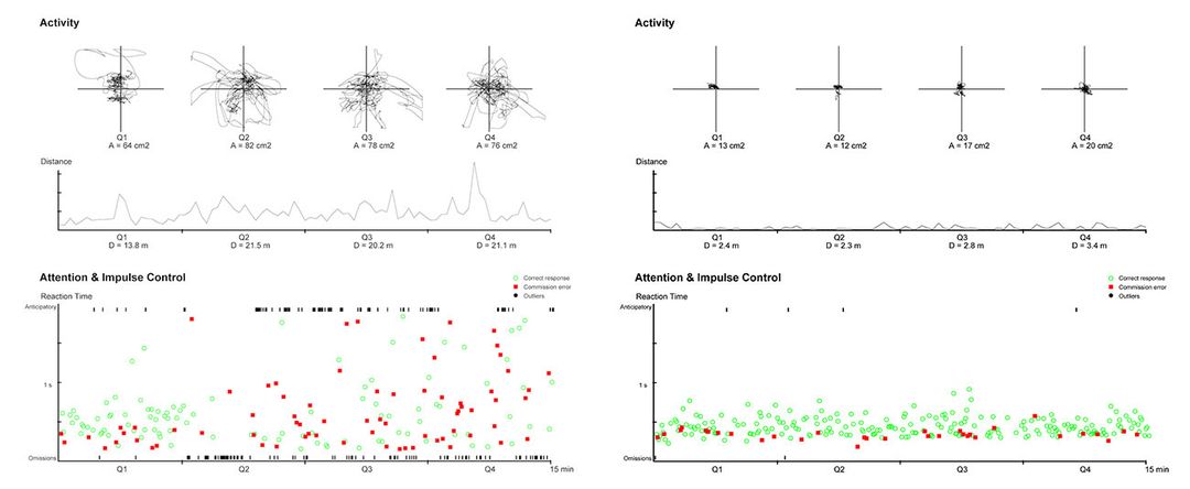 Comprehensive ADHD Testing and Diagnosis Services - Psychiatry Texas