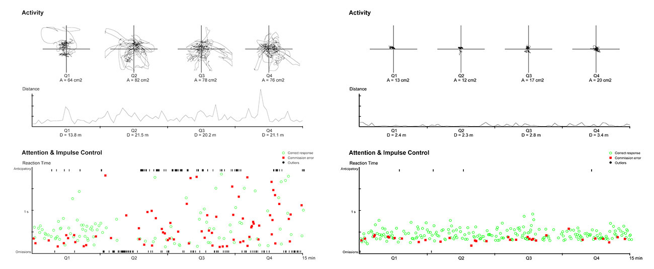 Comprehensive ADHD Testing and Diagnosis Services - Psychiatry Texas