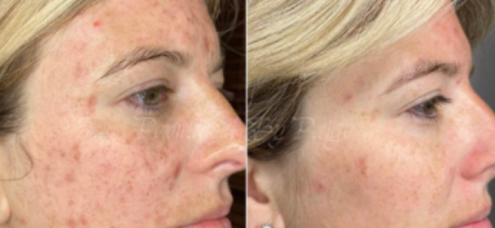 AZ Laser RX & Med Spa Scottsdale