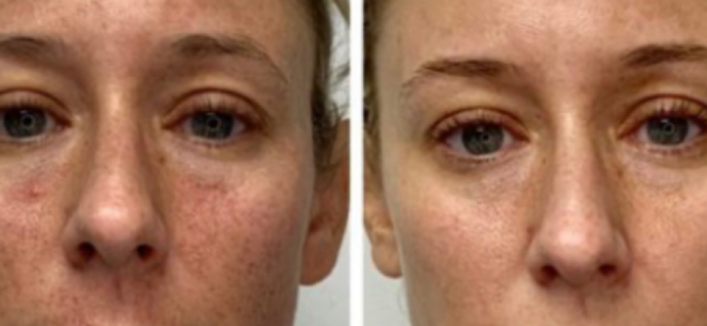 AZ Laser RX & Med Spa Scottsdale