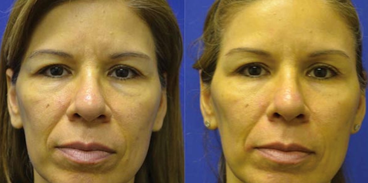 AZ Laser RX & Med Spa Scottsdale