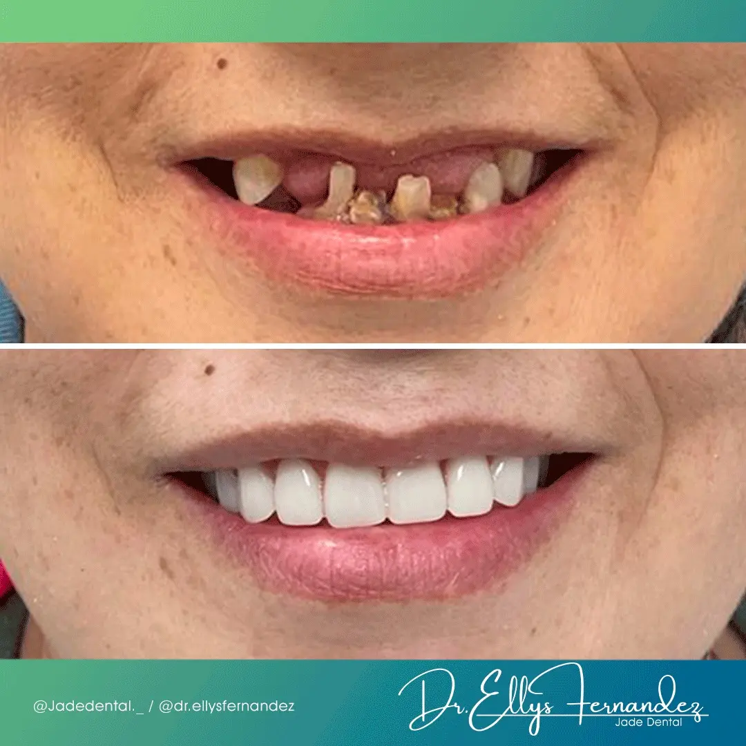 Smile Gallery | Jade Dental