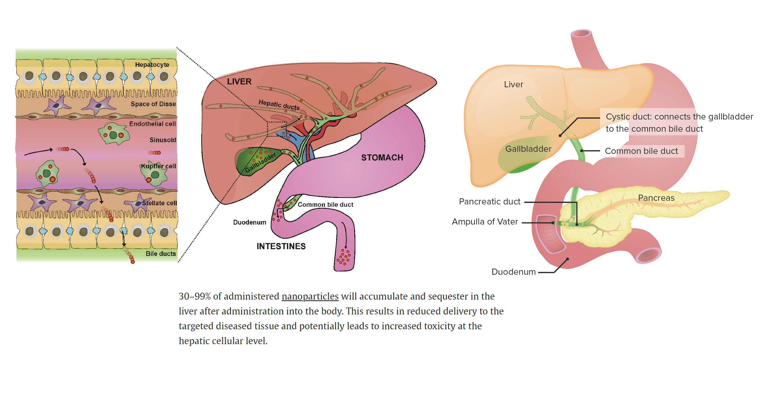 TURBO CANCER - Hepatobiliary System (Part 1) - Gallbladder Cancer and ...
