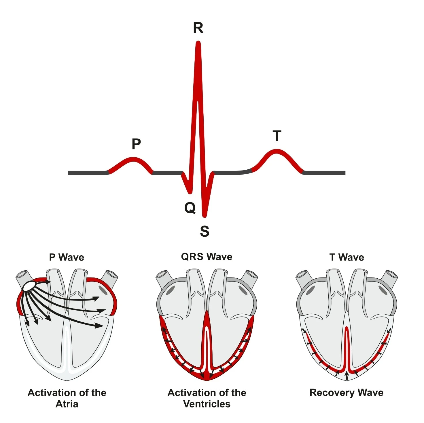 What is electrocardiogram (ECG)? How to read ECG Report?