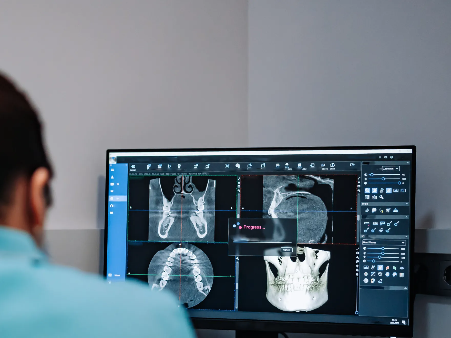 State-of-the-Art Dental Imaging Technology | Dynamic Dental, Covina